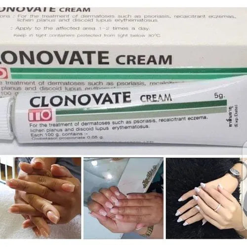 Clonovate Skin Lightening Cream-15g Very Effective – ELEGANT NATURALS KE