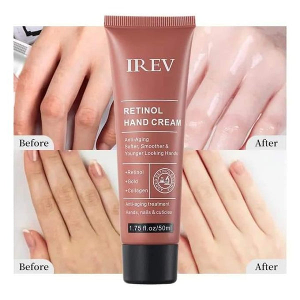 IREV Retinol hand cream – ELEGANT NATURALS KE